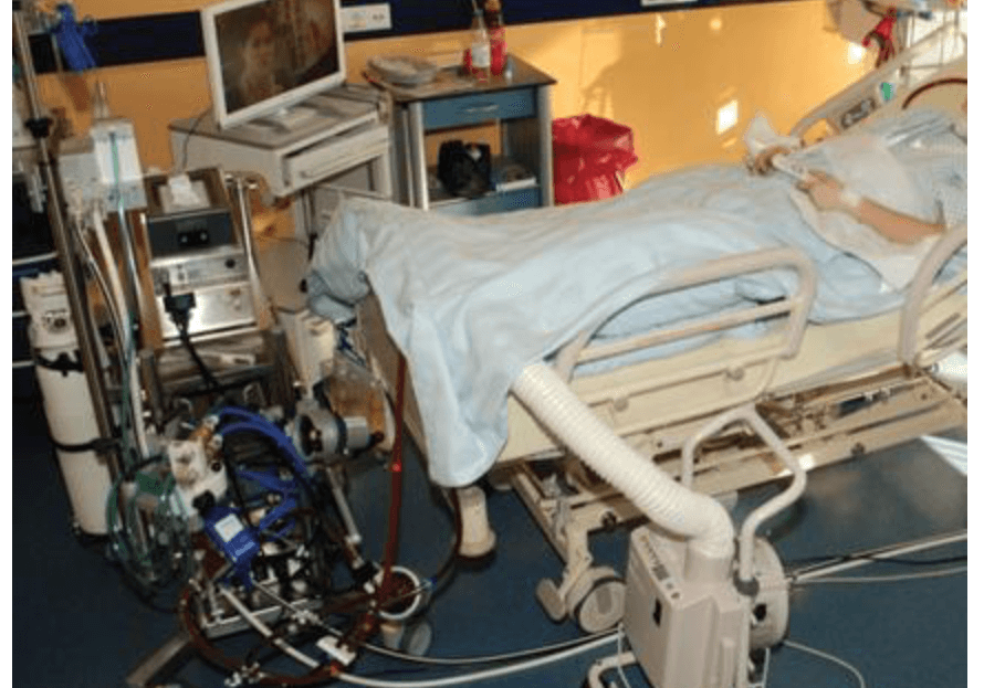 Hemovent is developing the world’s smallest and first self-contained ...